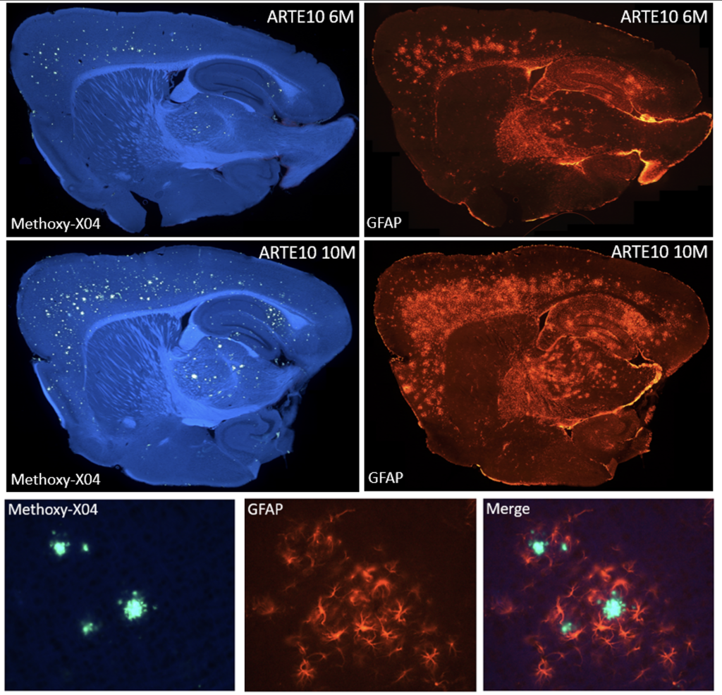 APP Transgenic Mice - Neurology CRO - InnoSer