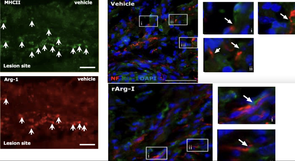 Spinal Cord Injury (SCI) Mouse Model | Neurology CRO