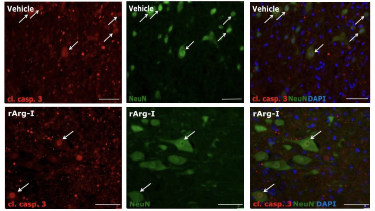 Spinal Cord Injury (SCI) Mouse Model | Neurology CRO