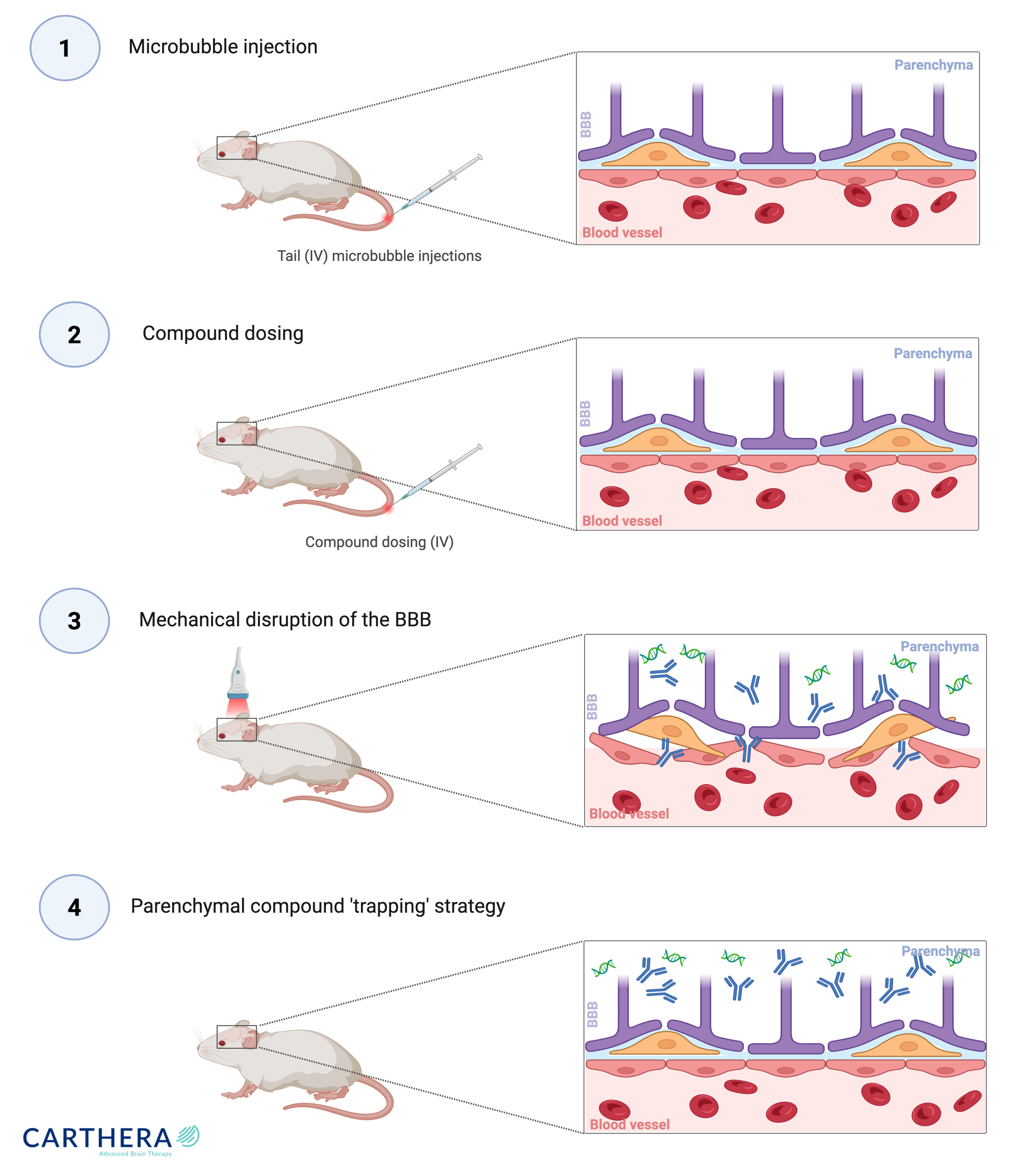 Ultrasound-mediated BBB drug delivery (SonoCloud®) - InnoSer